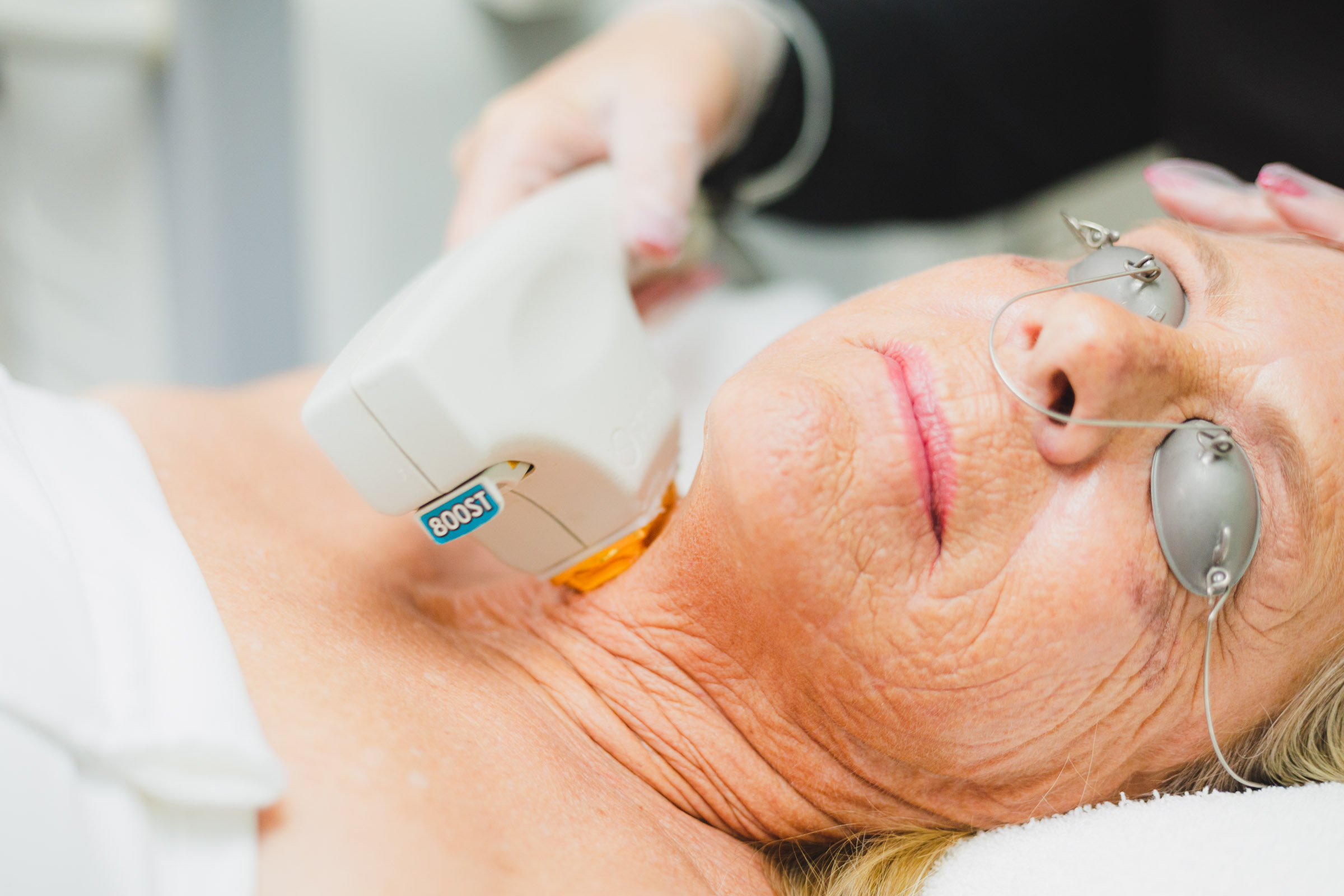 SkinTyte™ II in Kansas City | Aestheticare Medspa AesthetiCare