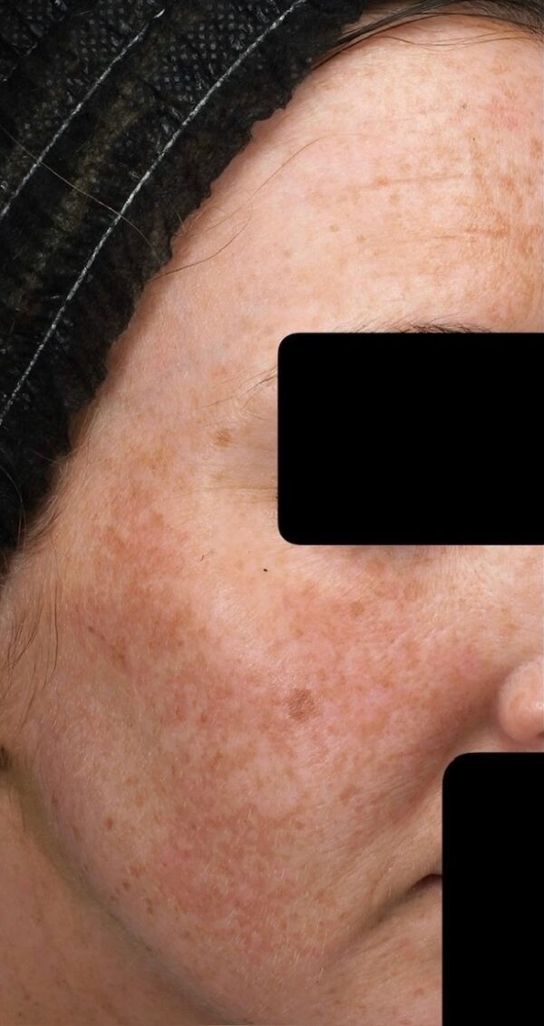 Dr. Amy Carter - AesthetiCare AesthetiCare