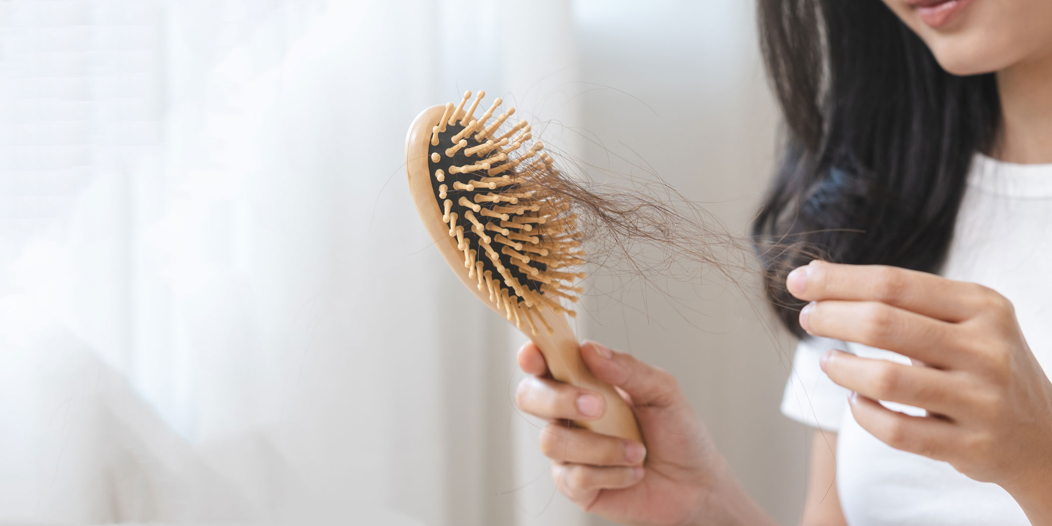 Hair Loss - AesthetiCare AesthetiCare