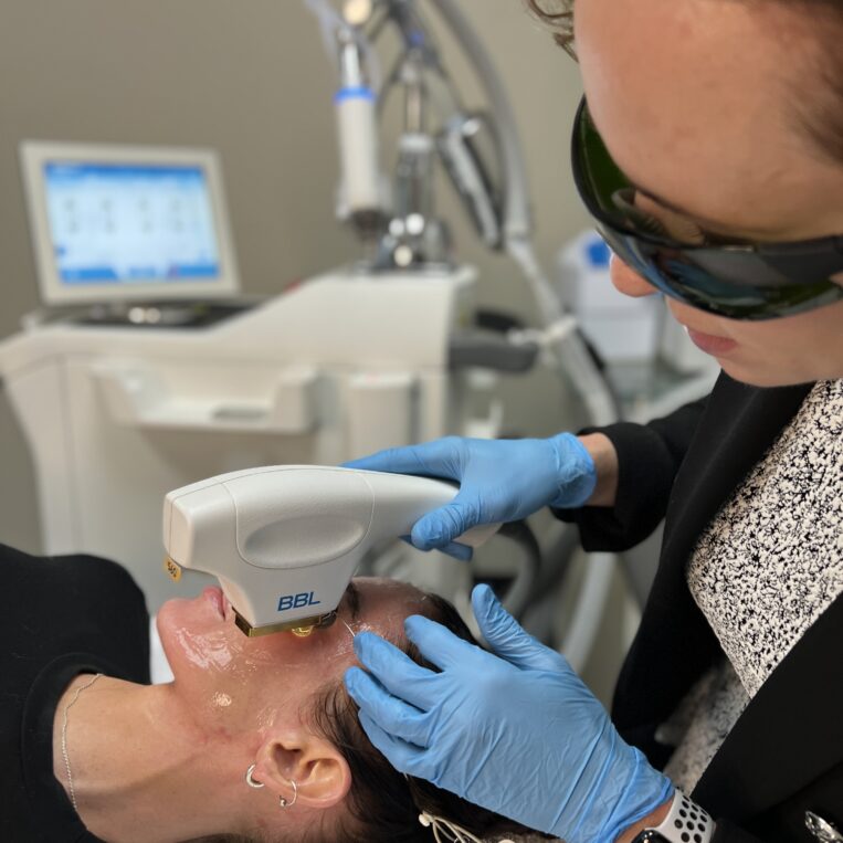 Rejuvenate Your Skin with Forever Young BBL! - AesthetiCare AesthetiCare